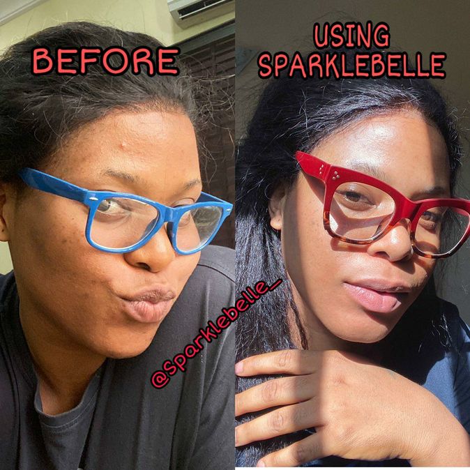 SparkleBelle – Handcrafted Luxury Skincare Products